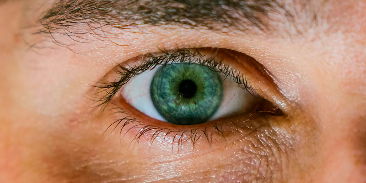 Cernes: Causes et remèdes maison pour les éliminer | HSN